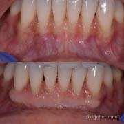 Periodontist Dallas, TX | Central Perio